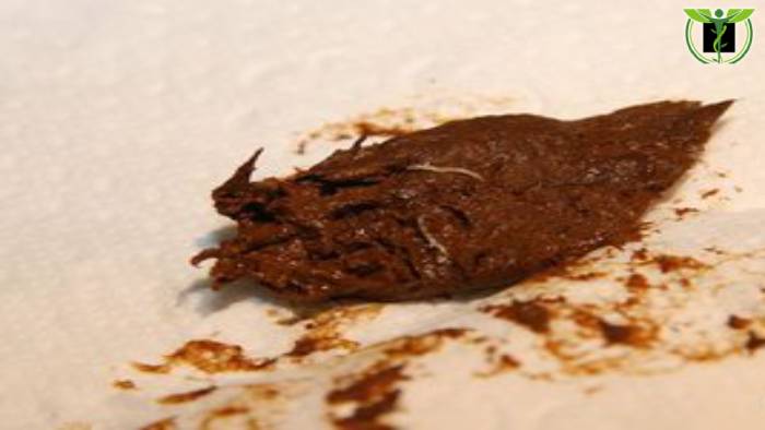 علائم انگلها در بزرگسالان و کودکان چیست؟ + انواع انگل - کلینیک مهنا